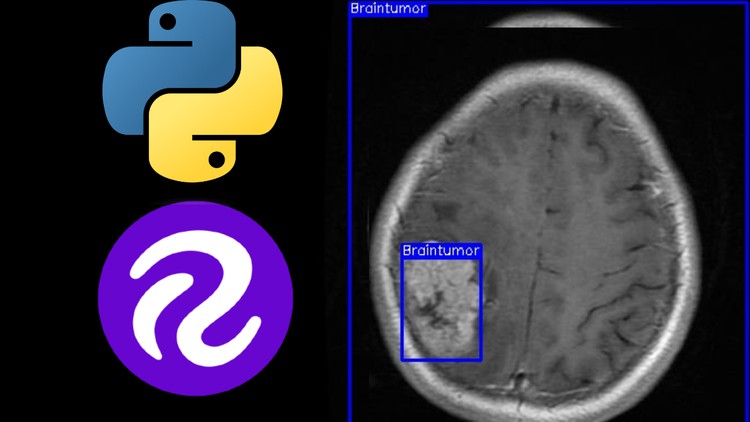 Brain Tumor Detection Using Yolov8 Complete Project Royalboss